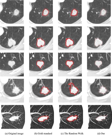 Comparison Of Segmentation Results Download Scientific Diagram