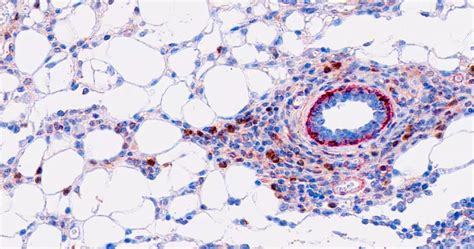病理实验外包 组织包埋 组织切片 免疫组化 形态染色 上海睿宝和生物科技有限公司