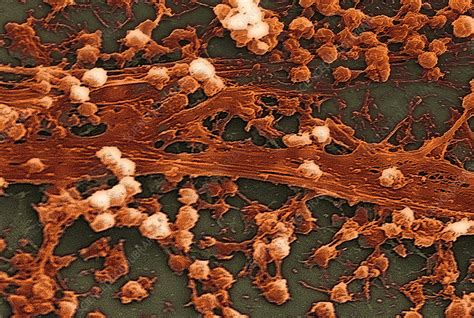 Staphylococcus Aureus Bacteria SEM Stock Image C028 3206 Science Photo Library