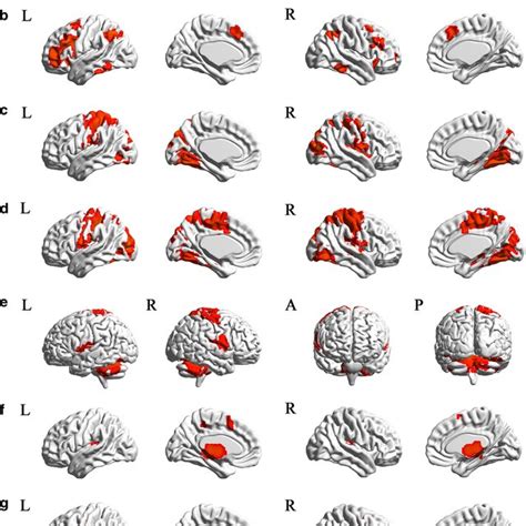 Spatial Maps Of Functionally Relevant Resting State Functional Download Scientific Diagram