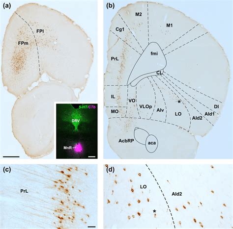 Low Power Photomicrographs Of Retrograde Labeling Resulting From A Ctb