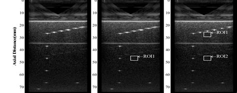 The B Mode Images Using Linear Probe Reconstructed By A The CON Download Scientific Diagram