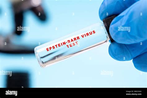 Epstein Barr Virus Saliva Test Screens For Antibodies Or Markers Of