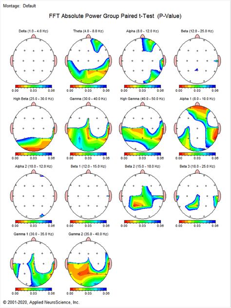 Absolute Power Paired T‐test P‐value Paired T‐test Was Used To Download Scientific Diagram