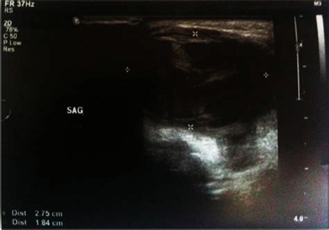Doppler Usg View Of The Mass Download Scientific Diagram