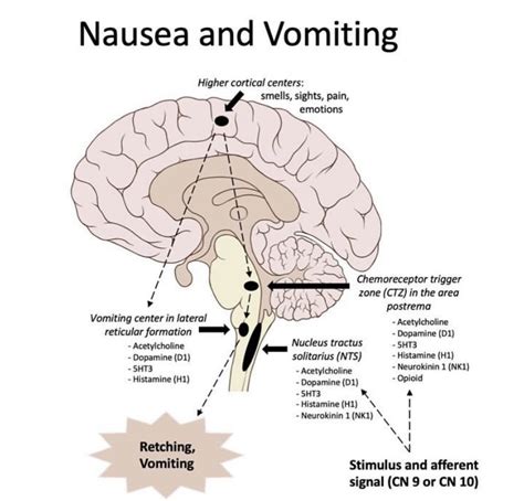 Vomiting Center Of The Brain Central Nervous System Pathways Of Nausea