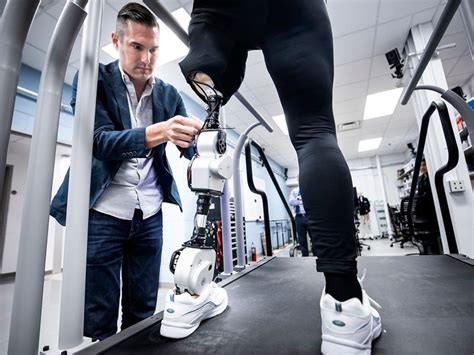 This Open Source Ai Powered Leg Is Streamlining Prosthetic Development