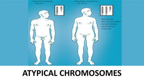 Gender And Atypical Sex Chromosomes Aqa Psychology Alevel 71823