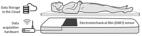 The Implemented Bcg System Consists Of A Bed Mounted Emfi Sensor Download Scientific Diagram