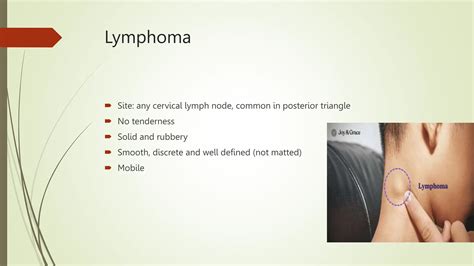 Neck Exam Pptx Cervical Lymph Node Examination PPTX
