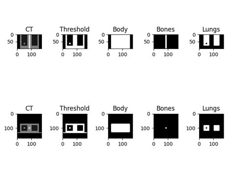Segmentation — Opentps Examples Documentation