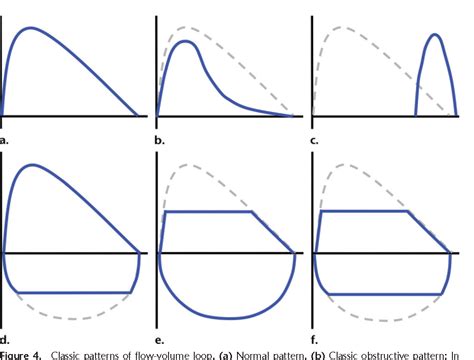 Table 2 From Pulmonary Function Tests For The Radiologist Semantic Scholar