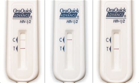 The Rise Of Targeted HIV Oral Rapid Testing In Australia The Medical