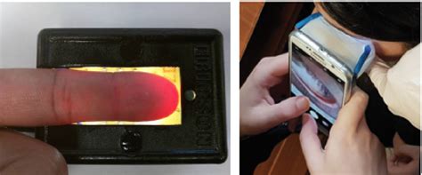 Figure 1 From Noninvasive Hemoglobin Level Prediction In A Mobile Phone Environment State Of