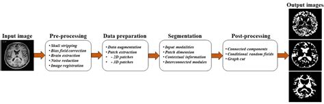 General Pipeline For Brain Mri Analysis General Pipeline For Brain Mri