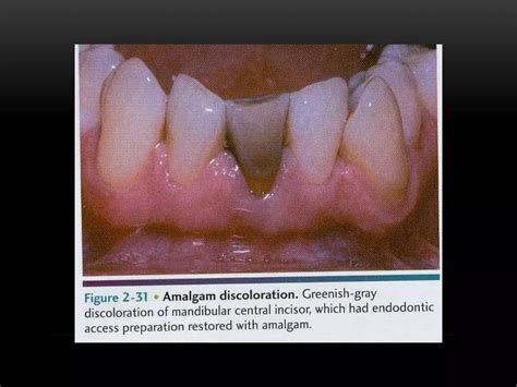 Lab 3 Developmental Defect Teeth Dina Pptx