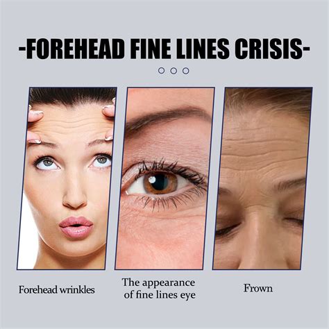 Sumllary Forehead Patch Moisturizing Hydrating Smoothing And Firming