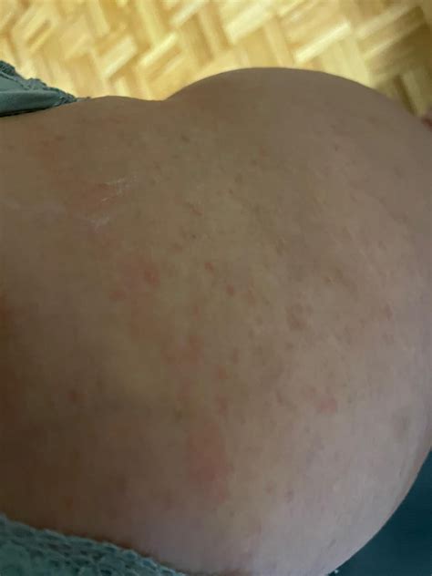 What Is This Please Help R Dermatologyquestions