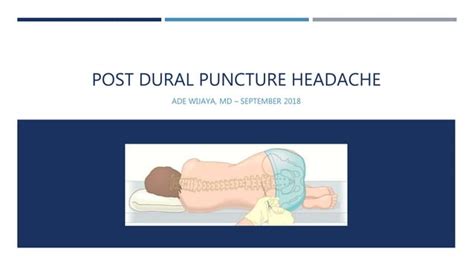 Post Dural Puncture Headache Pptx