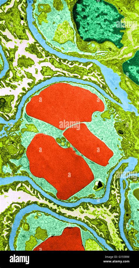 Color Enhanced Transmission Electron Micrograph Of Several Red Cells In