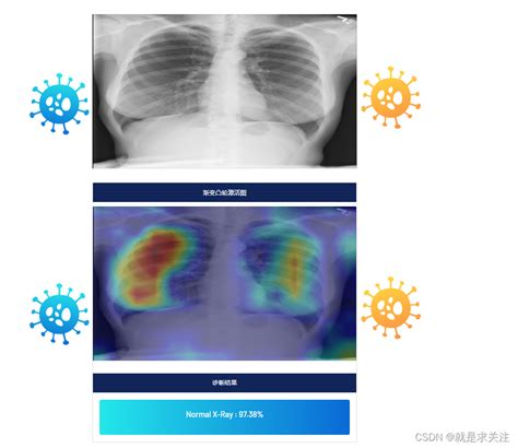 基于深度神经网络的肺炎检测系统实现