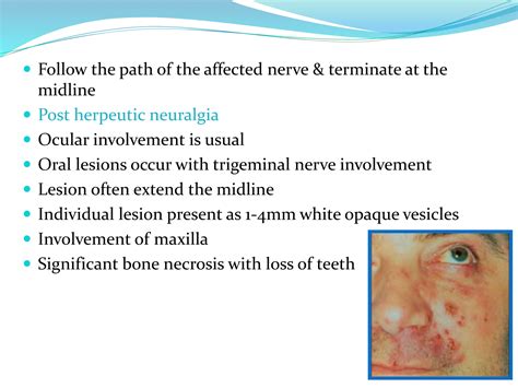 Dd Vesicular Lesions Ppt
