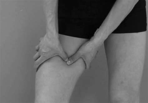 Groin Herniated Triggerpoints Fascial Distortion Model