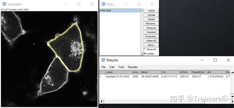 Imagej实用教程——细胞膜荧光强度检测 定量分析篇 知乎