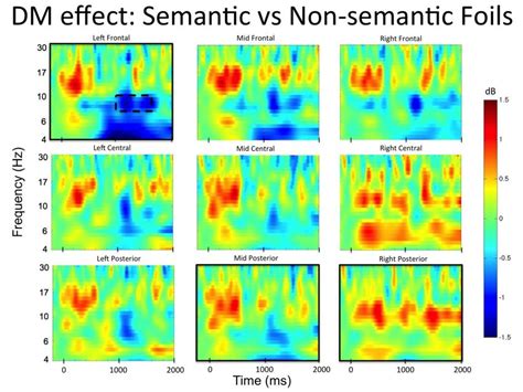Time Frequency Plots From The Left Frontal Cluster Illustrating EEG