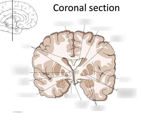 Coronal Section Diagram Quizlet