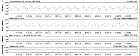 File Detailed View Png Apnea Board Wiki