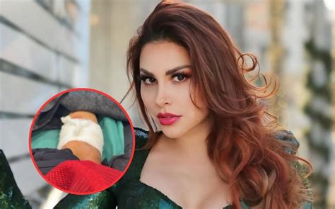Gaby Ramírez Es Hospitalizada Tras Ser Atacada Por Un Perrofama