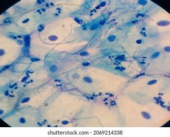 Betaproteobacteria Imagens Fotos E Vetores Stock Shutterstock