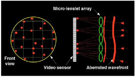 Advanced Optical Wavefront Technologies To Improve Patient Quality Of Vision And Meet Clinical