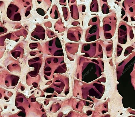 Bone Tissue SEM Stock Image F022 5777 Science Photo Library