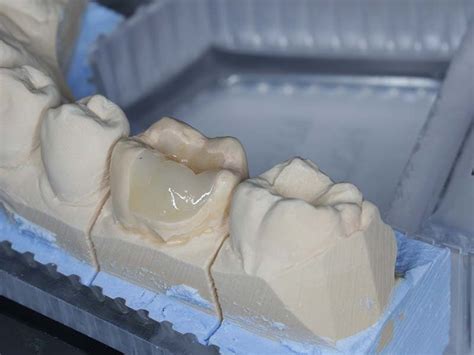 3D齒雕 兆品美學牙醫診所