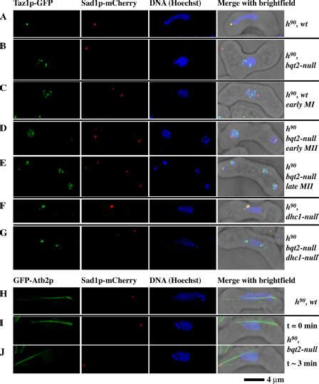 Defective Telomere Clustering And Chromosome Segregation But Normal Spb Download Scientific
