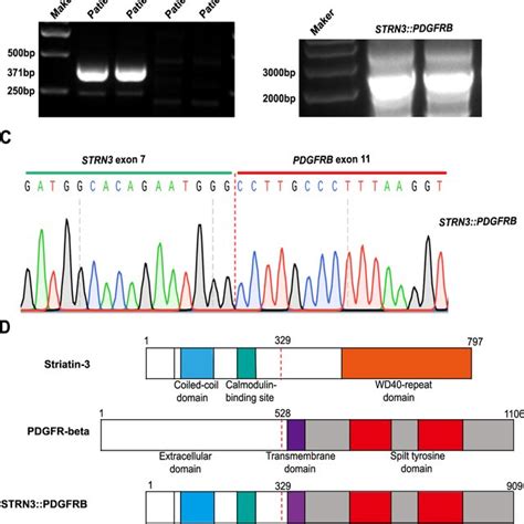 Clonal Architecture Of This Patient A Mutational Landscape Of Leukemia Download Scientific
