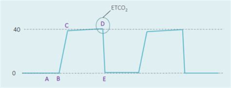 Capnography Waveform Patterns Flashcards Quizlet