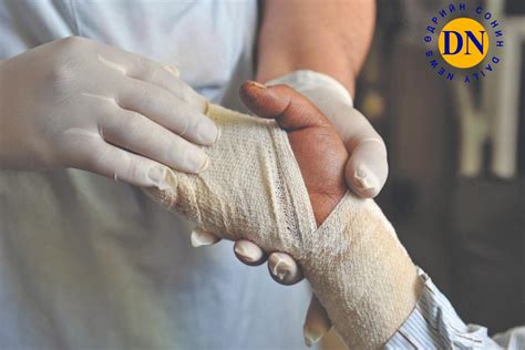 Халтиргаа гулгаанаас шалтгаалж 435 хүн гэмтжээ Dnn Mn