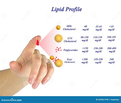 Lipid Profile Result Royalty Free Stock Image 64235968