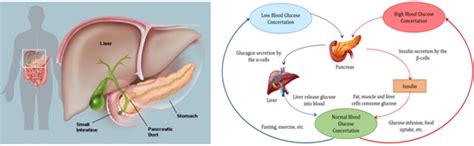 Artificial Pancreas Control Using Optimized Fuzzy Logic Based Genetic Algorithm Medcrave Online