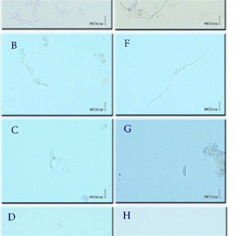 Optical Microscope Investigation Of Vegetative Growth Of Fusarium Download Scientific Diagram