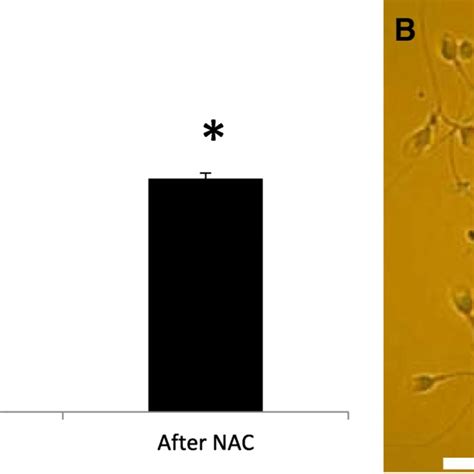 A Comparison Of Sperm Dna Fragmentation Before And After Treatment With Download Scientific
