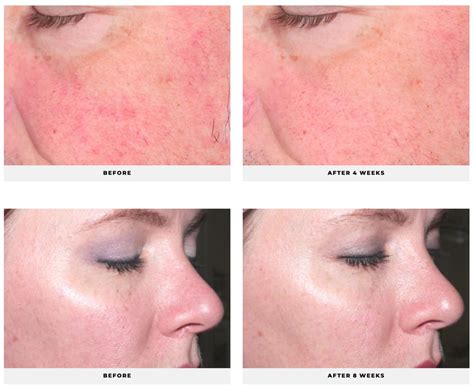 Age Reverse System Holistic Core Wellness Age Reverse System Holistic Core Wellness