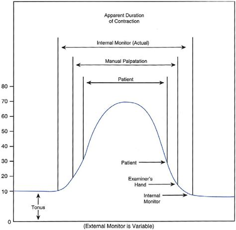 Fetal Heart Rate Auscultation 4th Edition Nursing For Womens Health