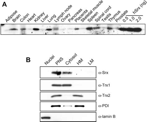 Characterization Of Mammalian Sulfiredoxin And Its Reactivation Of
