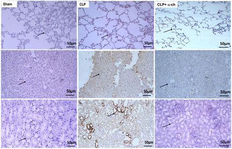 Protective Effect Of Alpha Chymotrypsin Against Sepsis Induced High Download Scientific Diagram