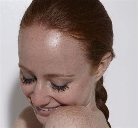 Ask A Redhead Link Between Freckles And Redheads H2BAR
