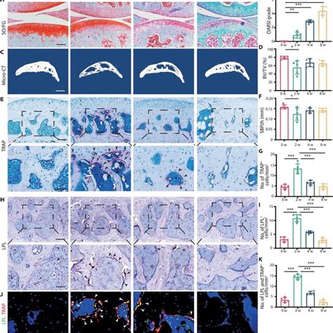 Oxygen From The Subchondral Bone Leads To Cartilage Degeneration